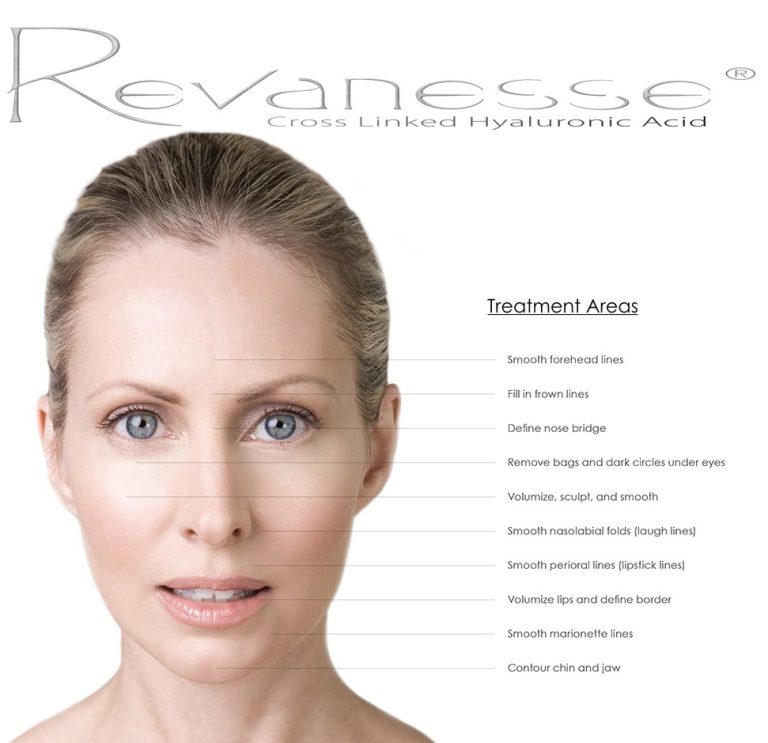 Revanesse Versa Dermal Filler Cost | Dallas, Plano, Austin, Texas Med Spa
