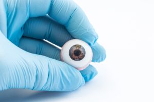 Enucleation & Evisceration Of The Eye | Dallas, Plano TX Ophthalmic surgeon